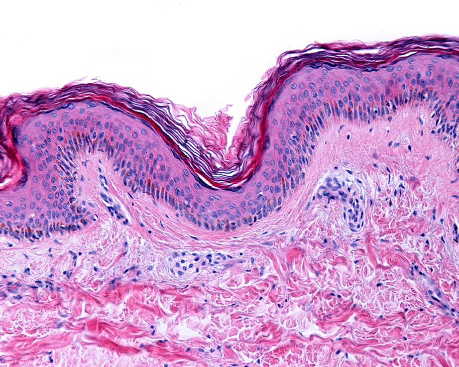 THE EFFECT OF A DAMAGED SKIN BARRIER AND HOW TO FIX IT – Codex Labs Corp