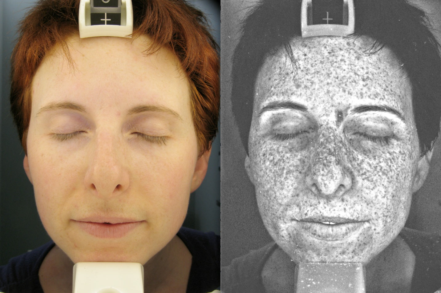 SUMMER SURVIVAL GUIDE ON HOW TO COPE WITH SUN SENSITIVITY – Codex Labs Corp