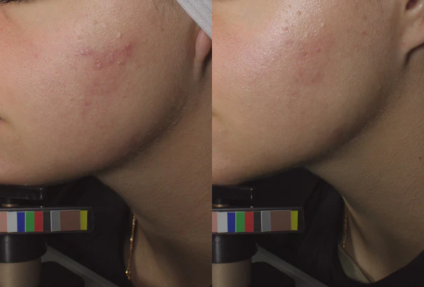 Codex Labs Bioscience Led Clean Skincare Codex Labs Corp