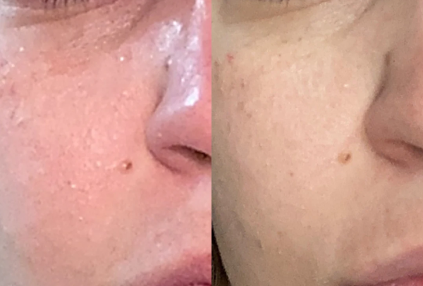 Codex Labs Bioscience Led Clean Skincare Codex Labs Corp